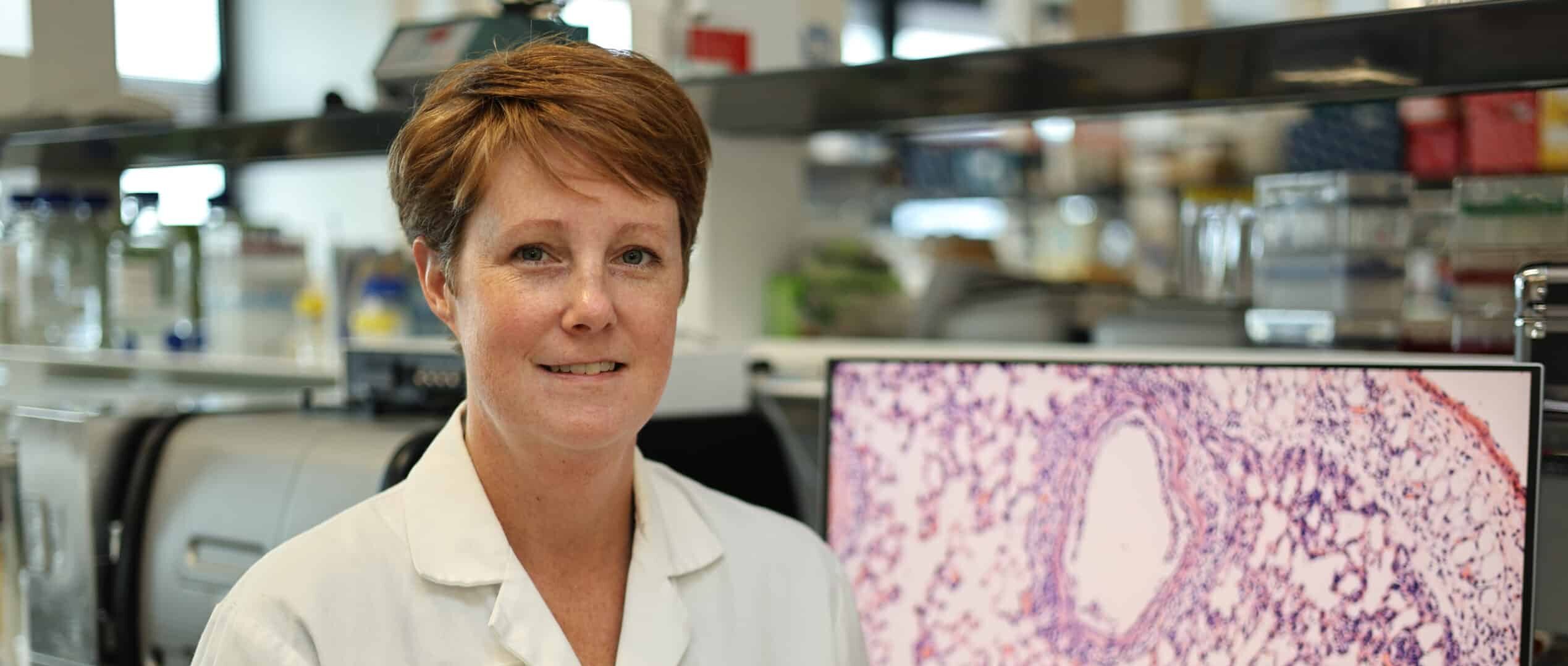 Influenza - Hudson Institute of Medical Research